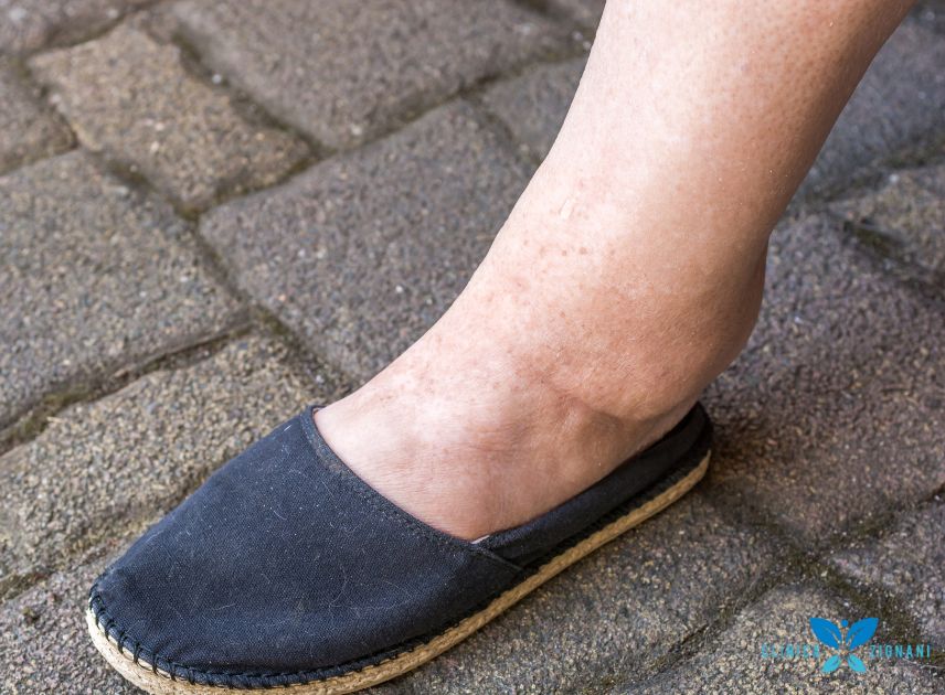 Pernas inchadas: compreenda suas causas e o que fazer